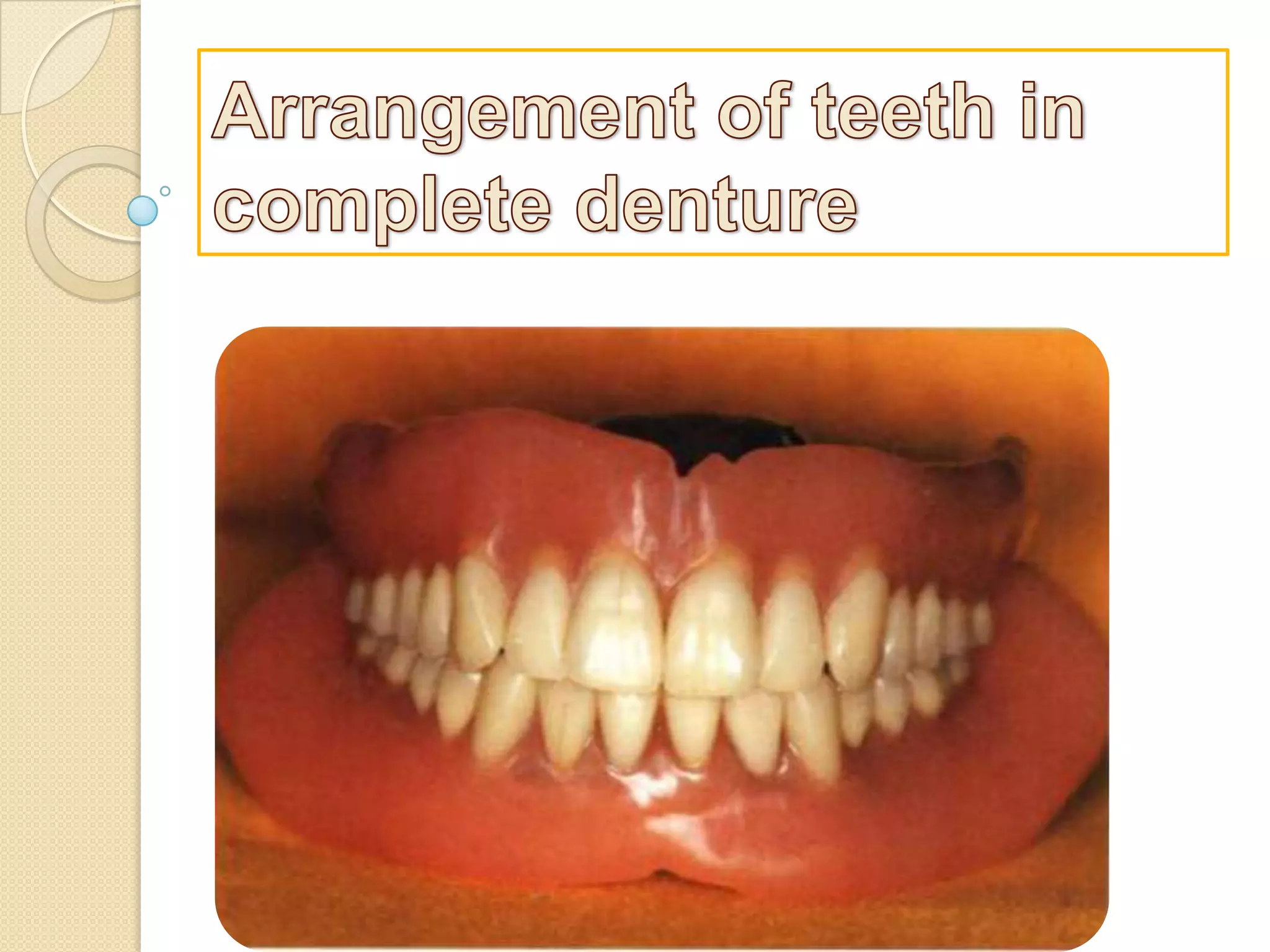 Arrangement of teeth in complete denture | PPTX