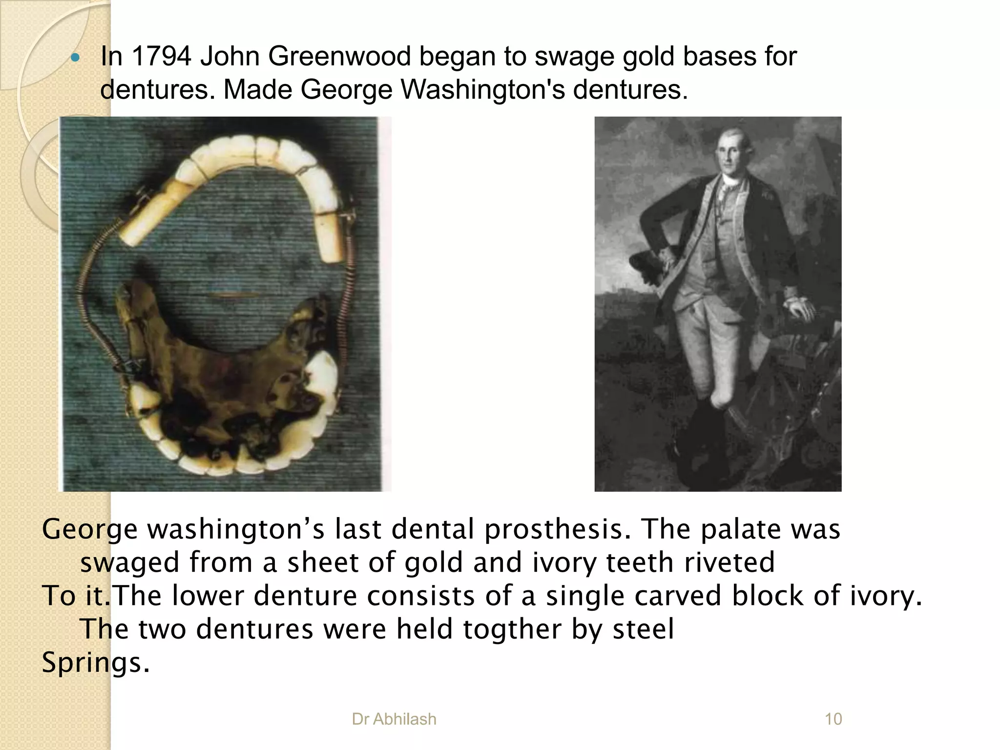 Arrangement of teeth in complete denture | PPTX