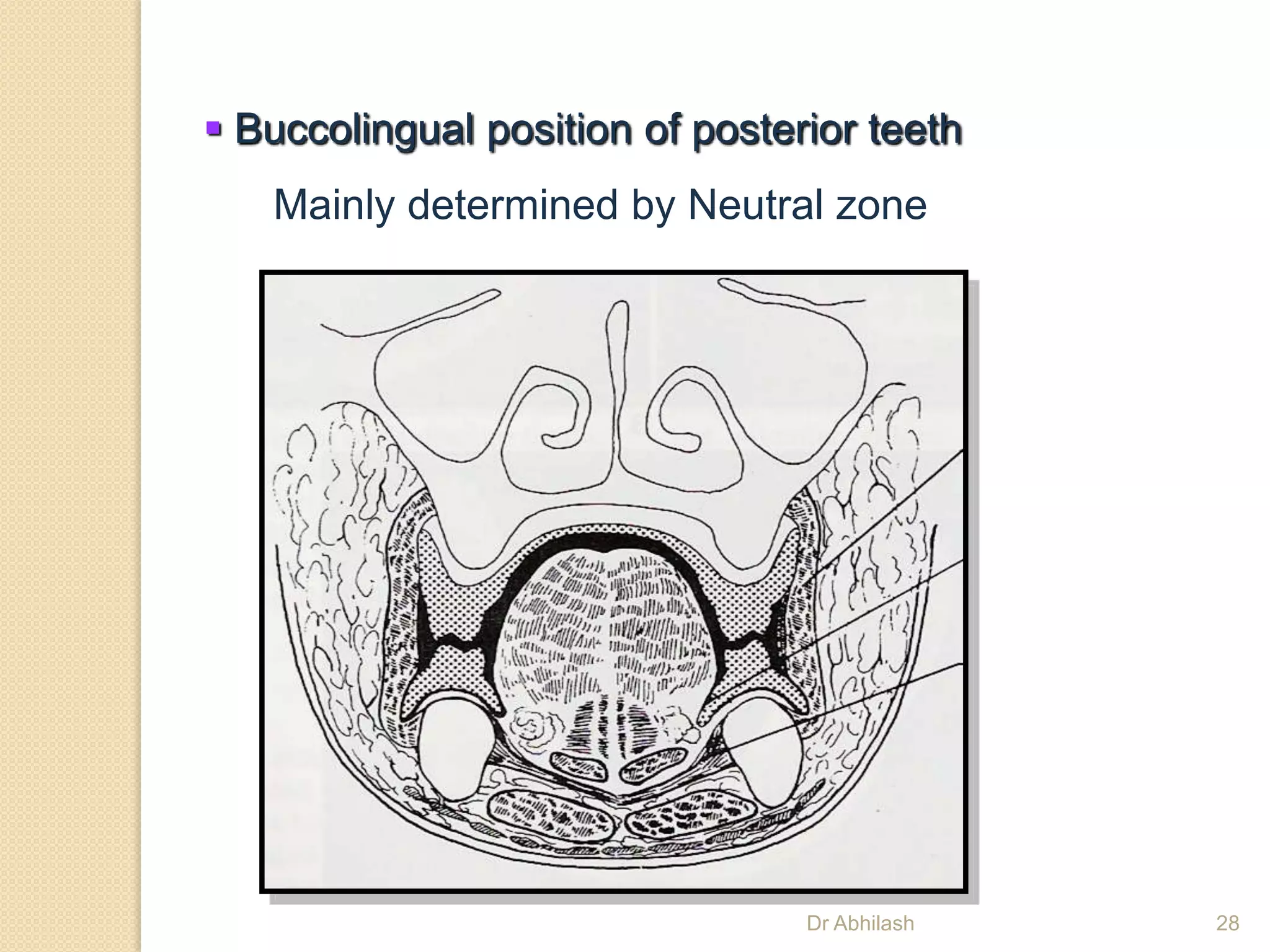 Arrangement of teeth in complete denture | PPTX