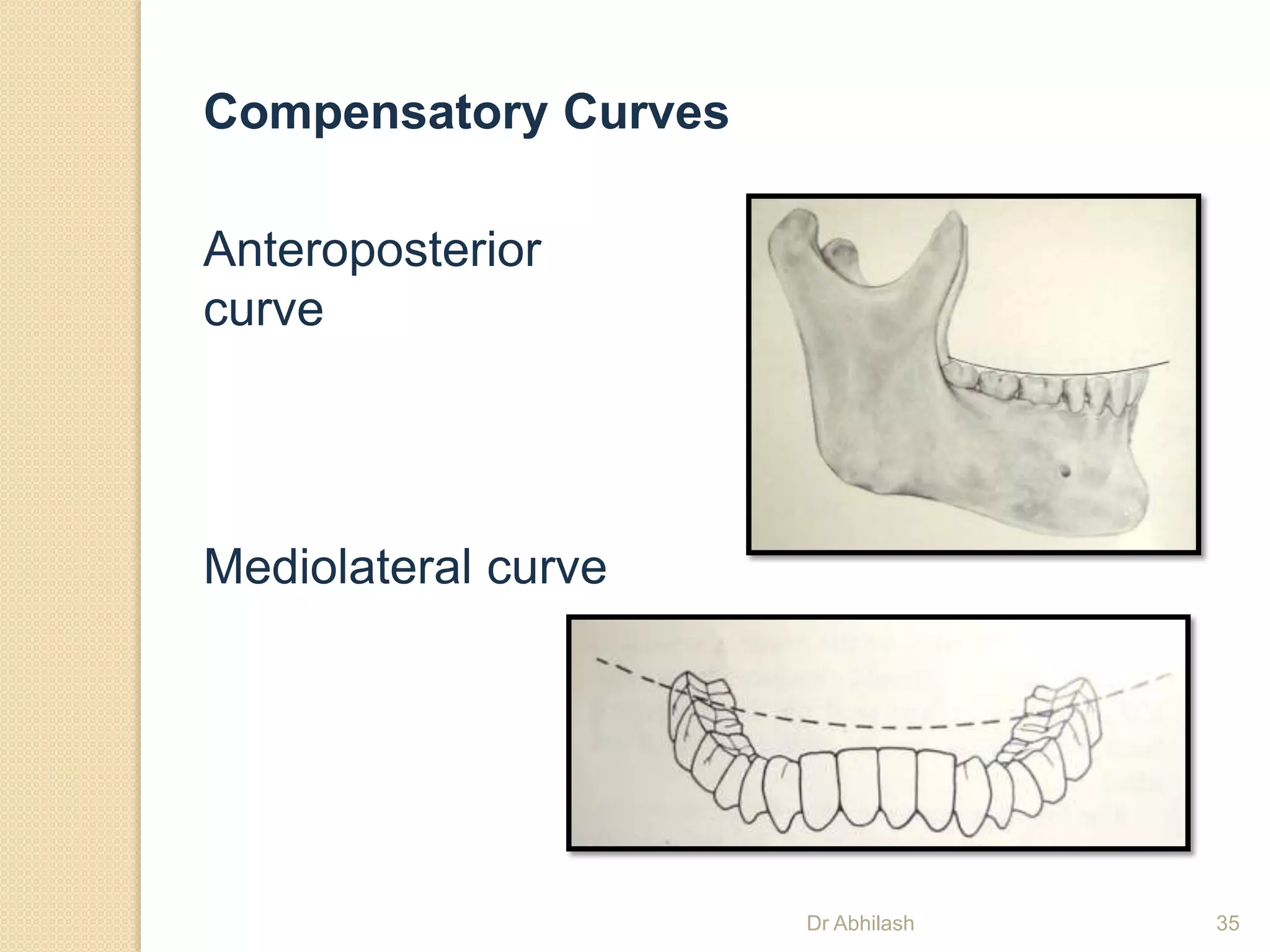 Arrangement of teeth in complete denture | PPTX