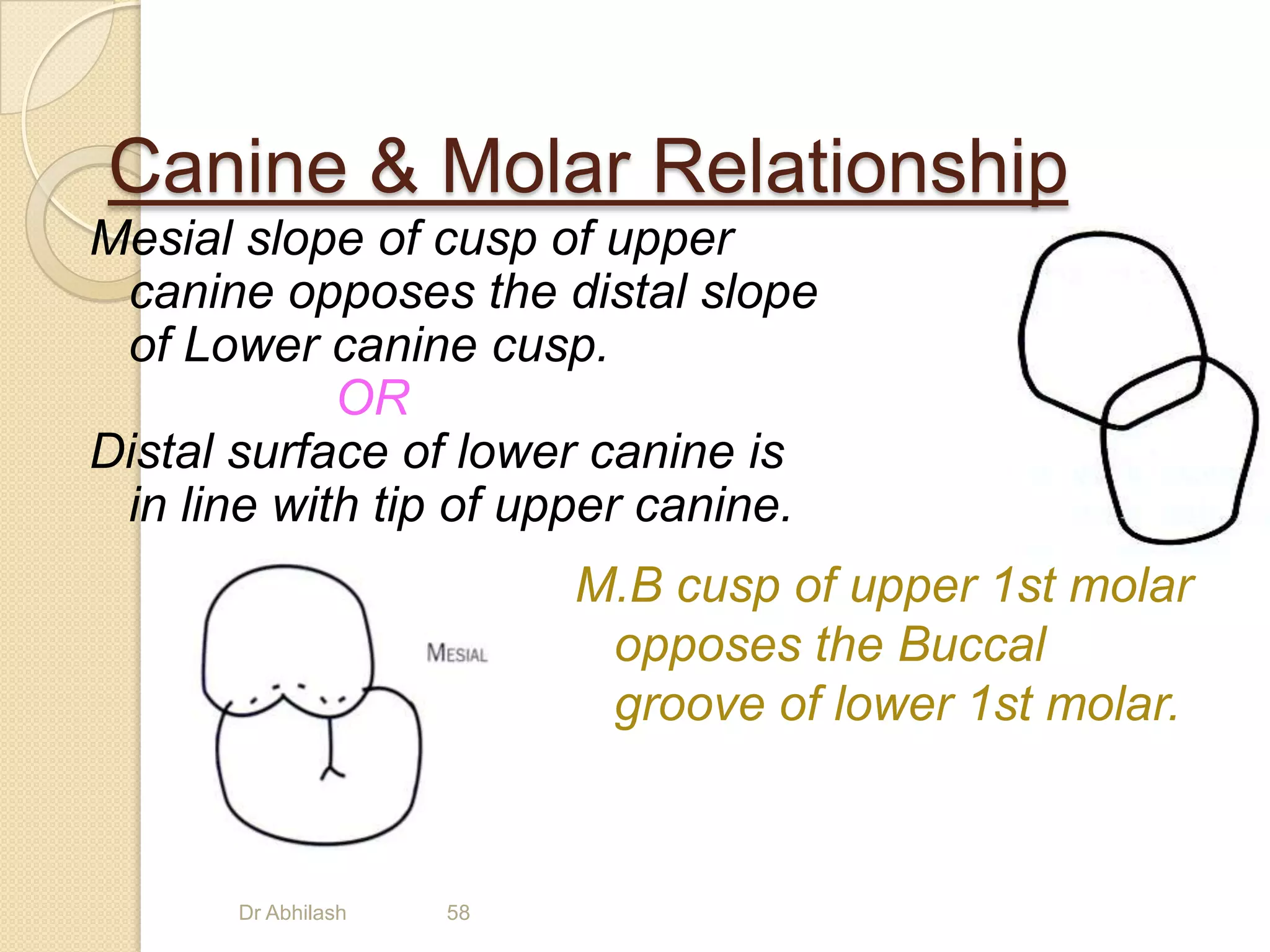 Arrangement of teeth in complete denture | PPTX