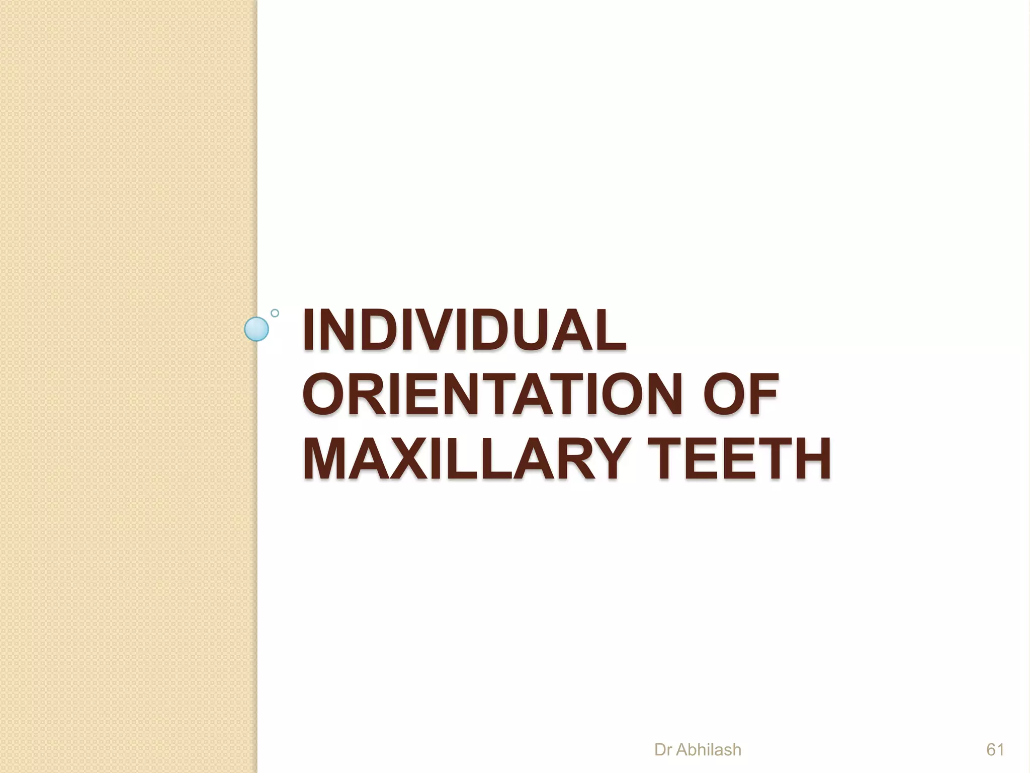 Arrangement of teeth in complete denture | PPTX