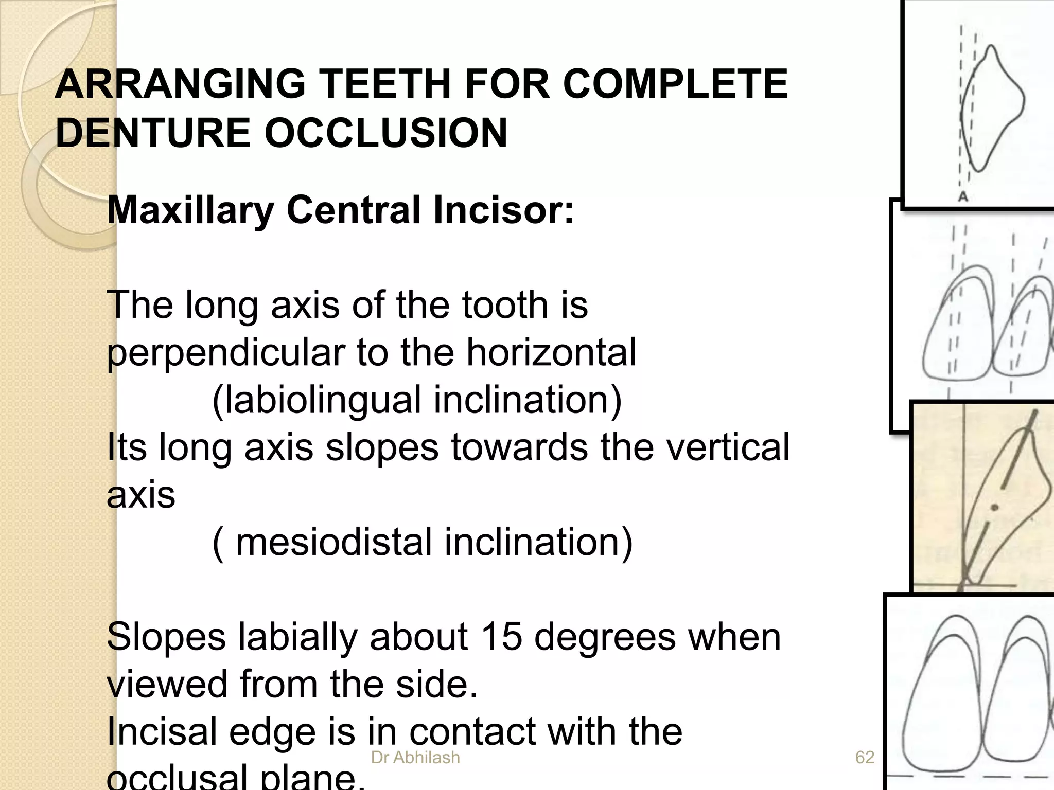 Arrangement of teeth in complete denture | PPTX