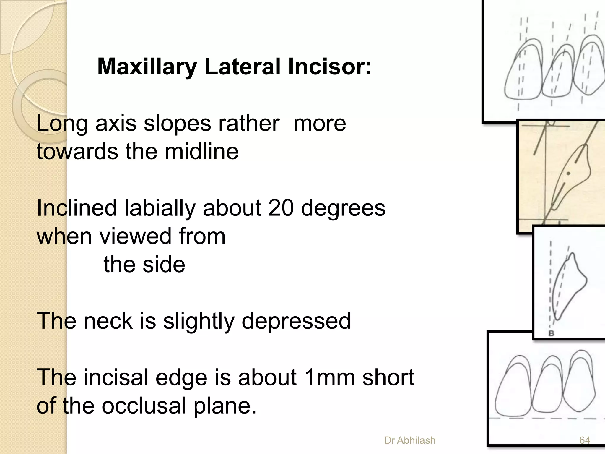 Arrangement of teeth in complete denture | PPTX