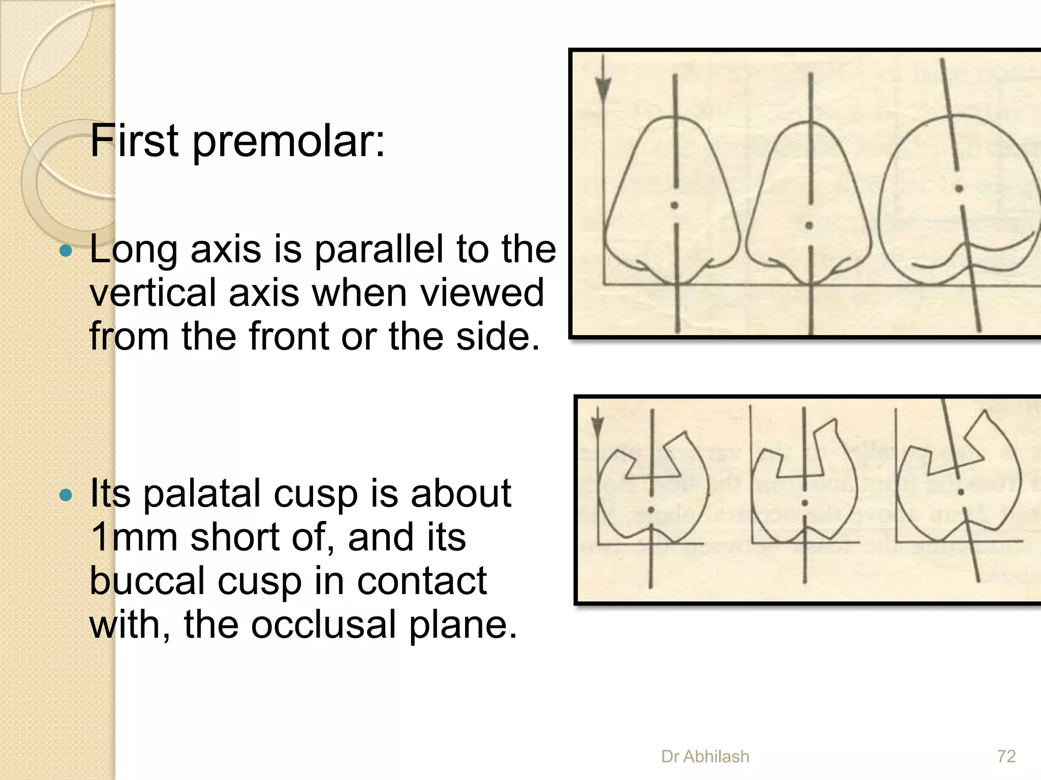 Arrangement of teeth in complete denture | PPTX