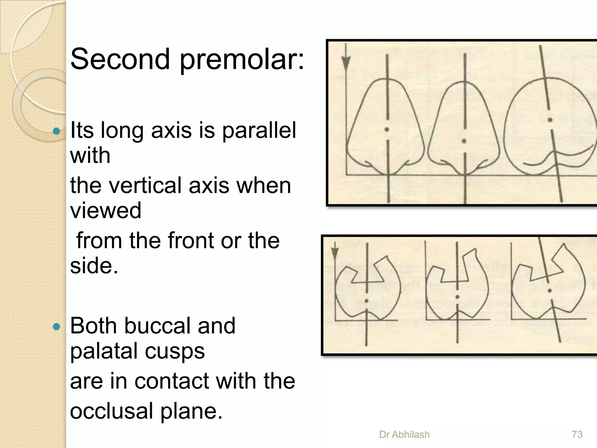 Arrangement of teeth in complete denture | PPTX