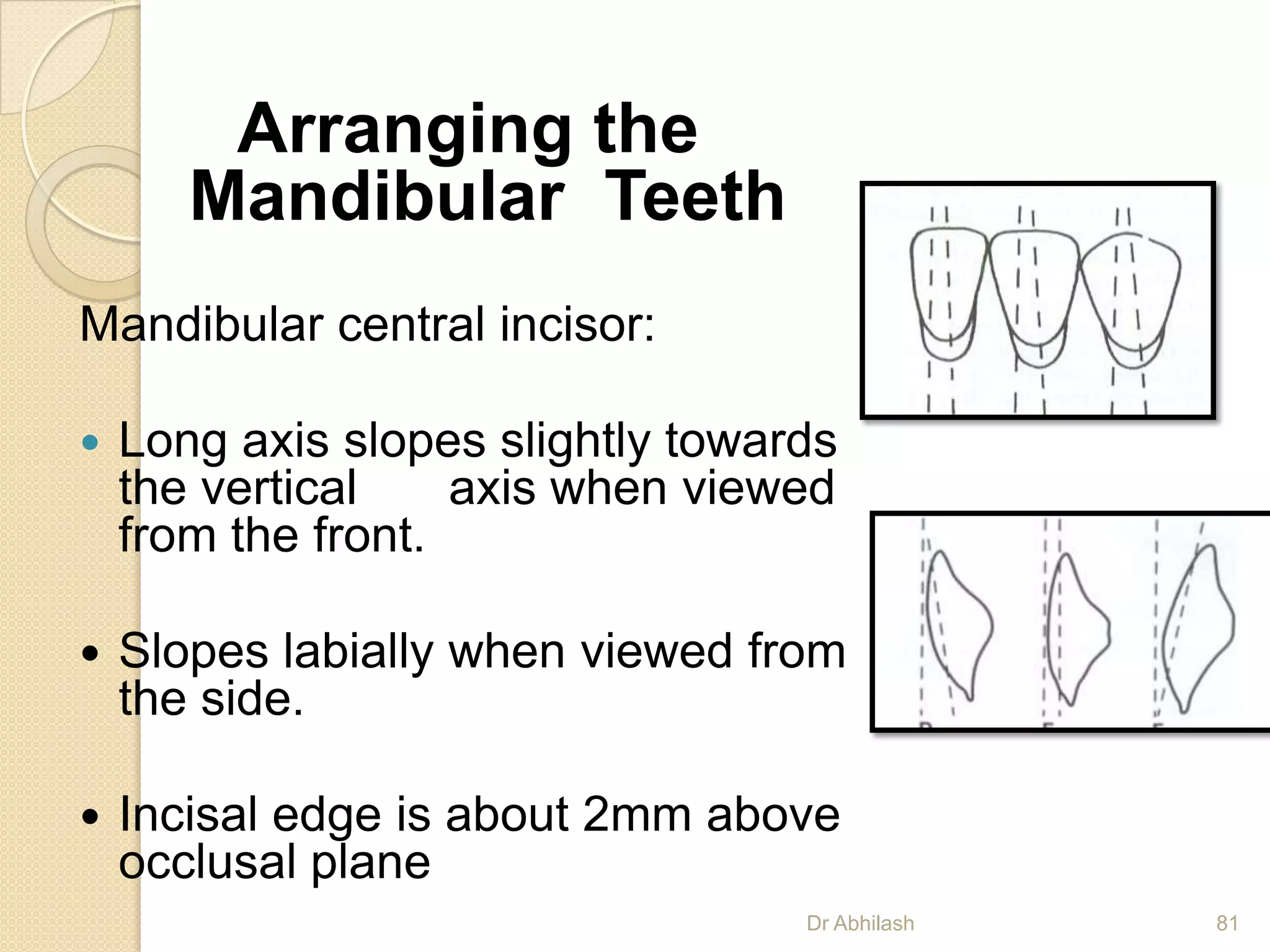 Arrangement of teeth in complete denture | PPTX