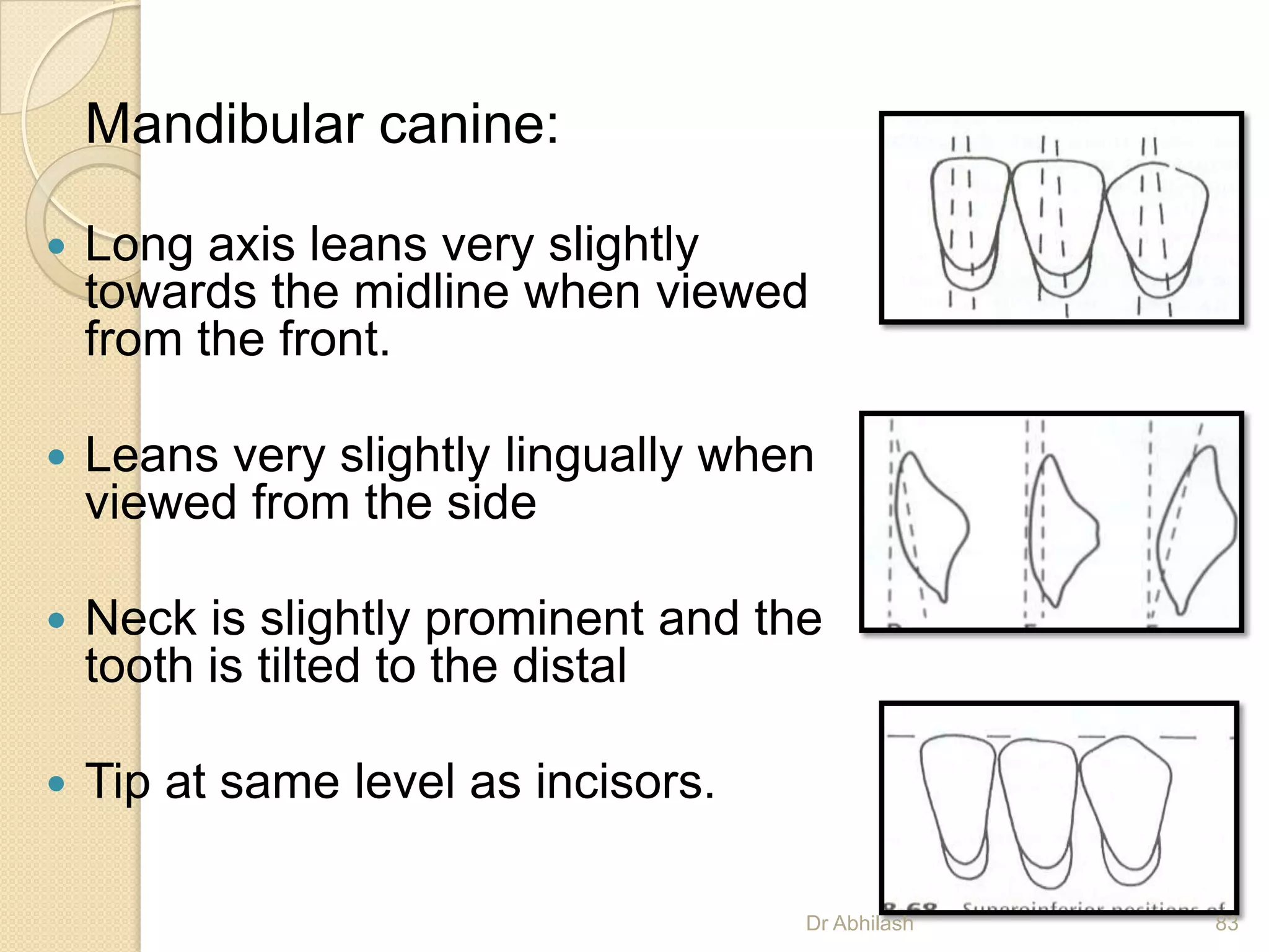 Arrangement of teeth in complete denture | PPTX