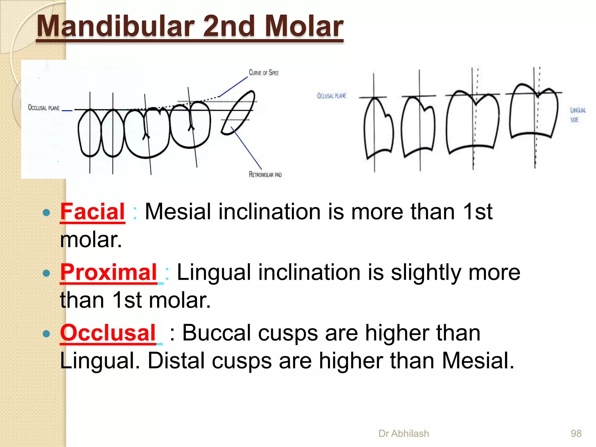 Arrangement of teeth in complete denture | PPTX