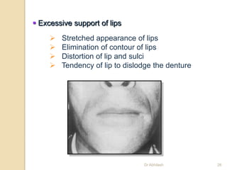Arrangement of teeth in complete denture | PPTX