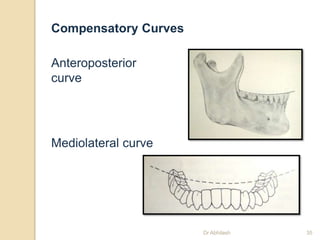 Arrangement of teeth in complete denture | PPTX