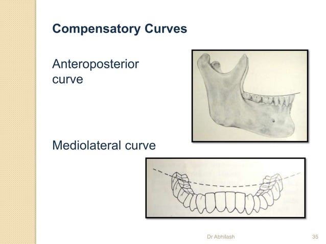 Arrangement of teeth in complete denture | PPTX