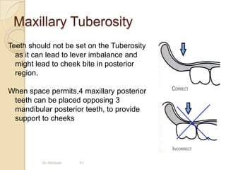 Arrangement of teeth in complete denture | PPT