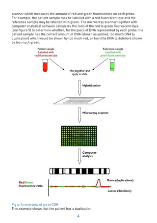 Array cgh ftnw | PDF
