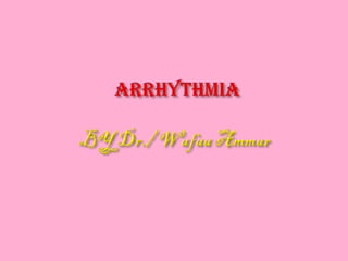 ARRHyTHMIA BY Dr./ Wafaa Ammar | PDF