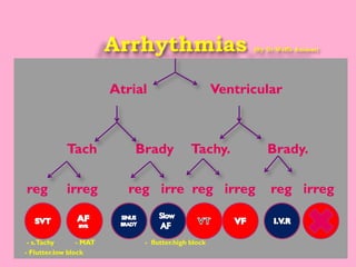 ARRHyTHMIA BY Dr./ Wafaa Ammar | PDF