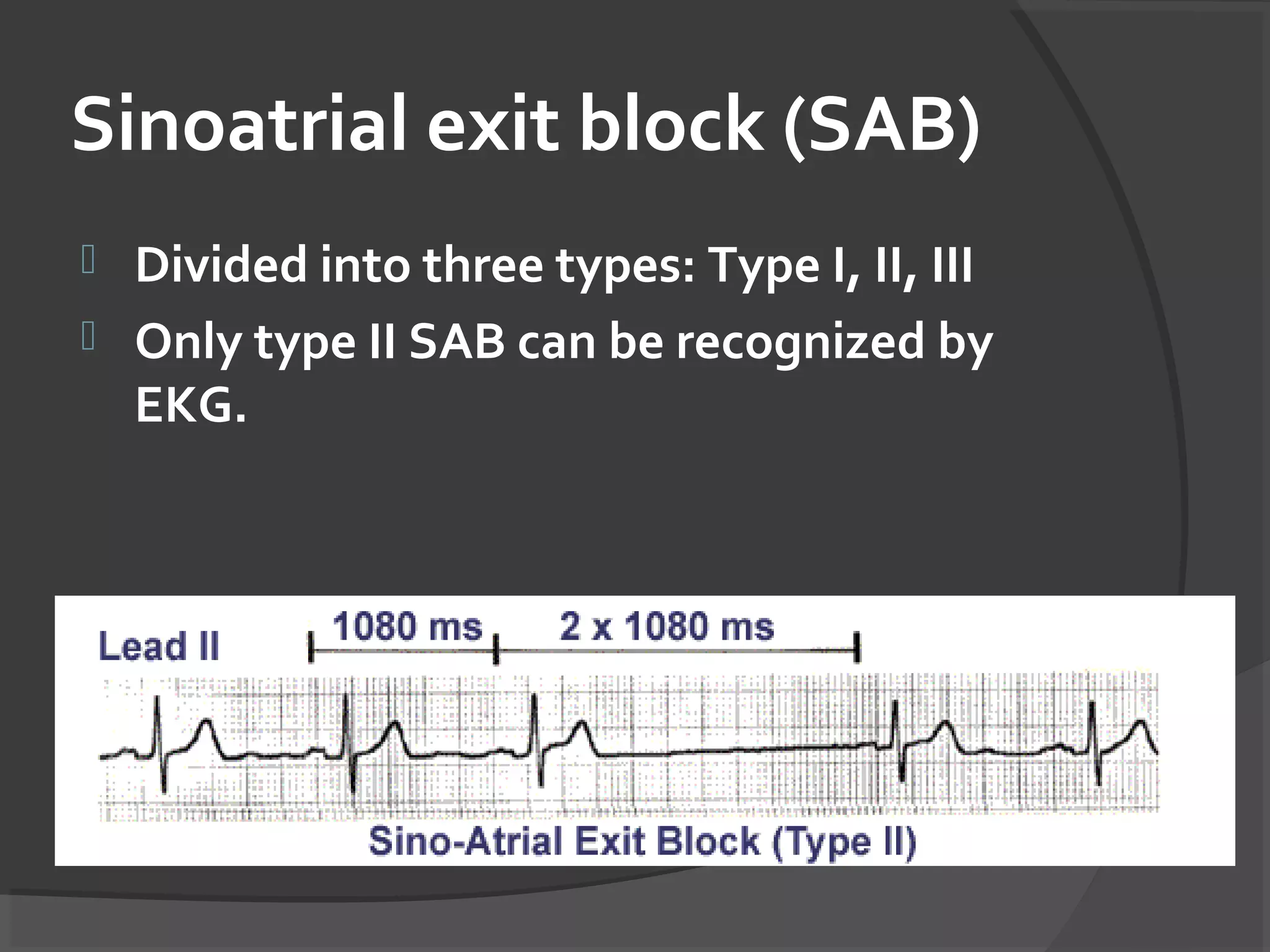 Arrhythmia | PPT