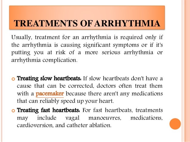 Arrhythmia : Causes, Symptoms and Treatment Arrhythmia : Causes, Symptoms and Treatment