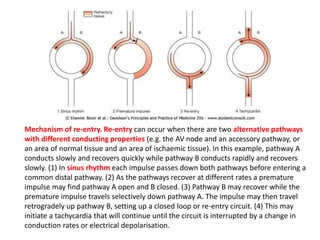 CARDIAC ARRHYTHMIAS | PPTX