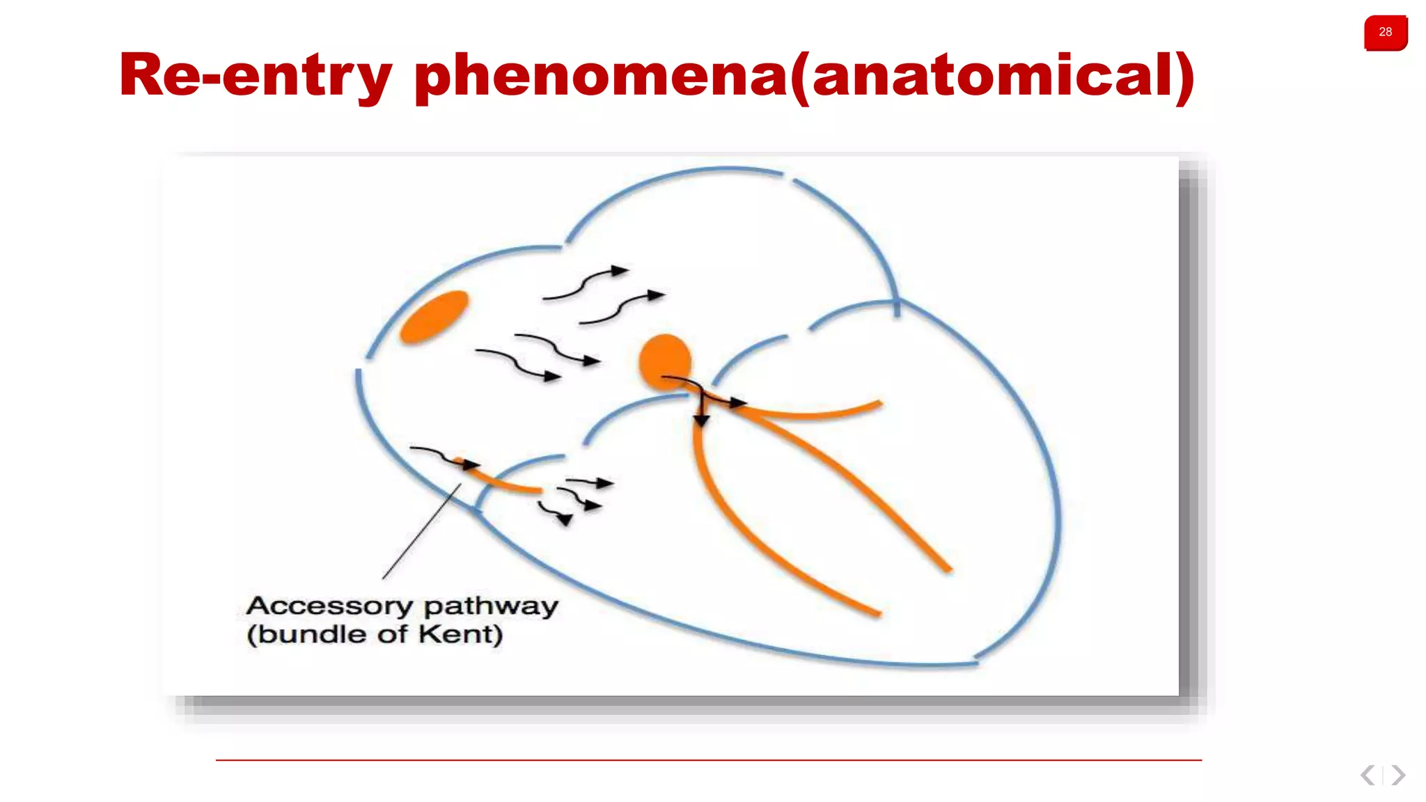Management of cardiac arrhythmias | PPTX