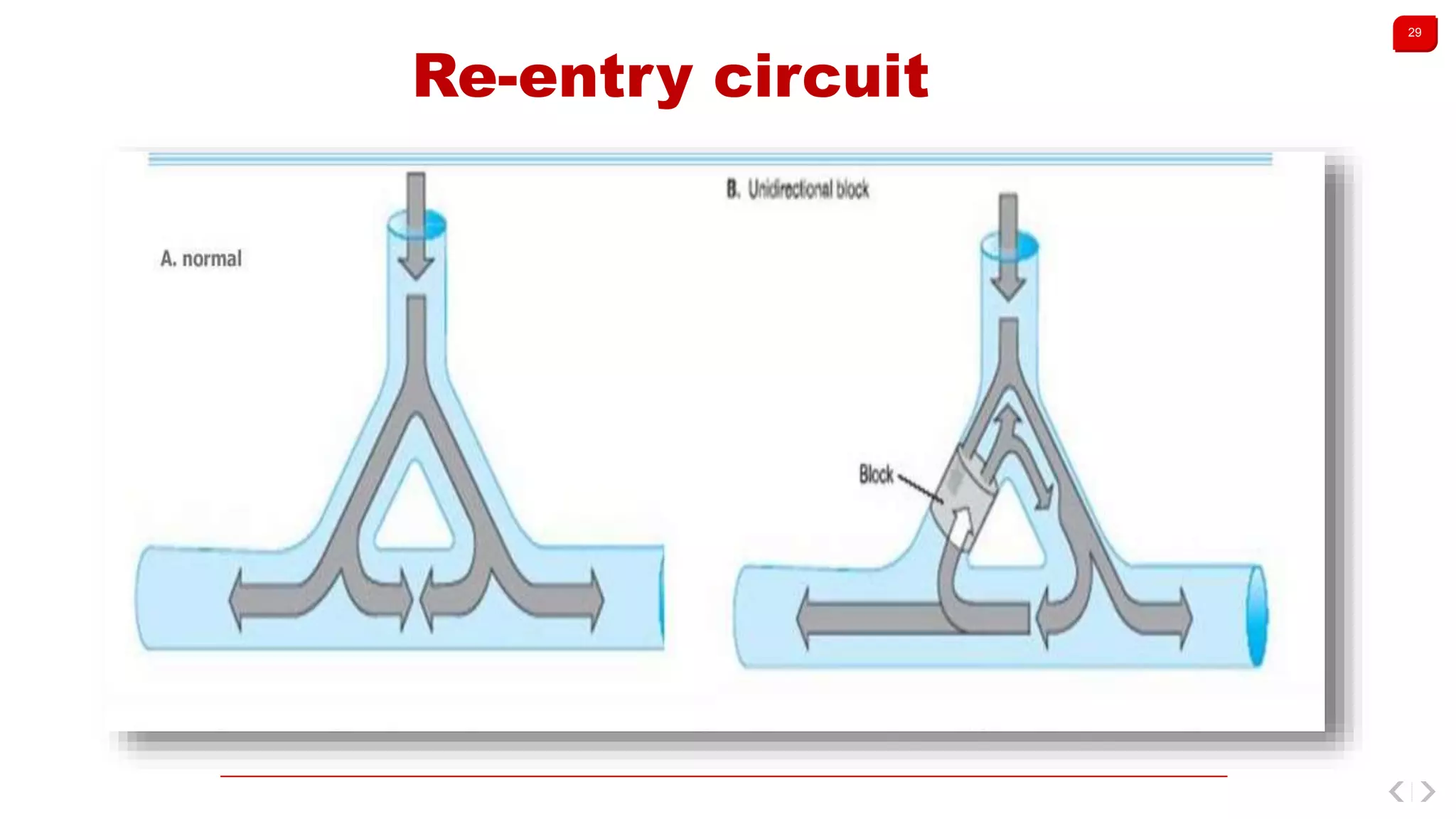 Management of cardiac arrhythmias | PPTX