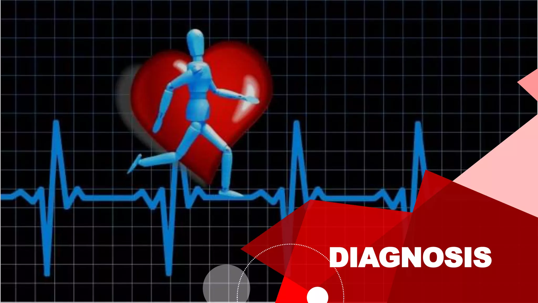 Management of cardiac arrhythmias | PPTX | Heart and Cardiovascular Diseases | Diseases and ...