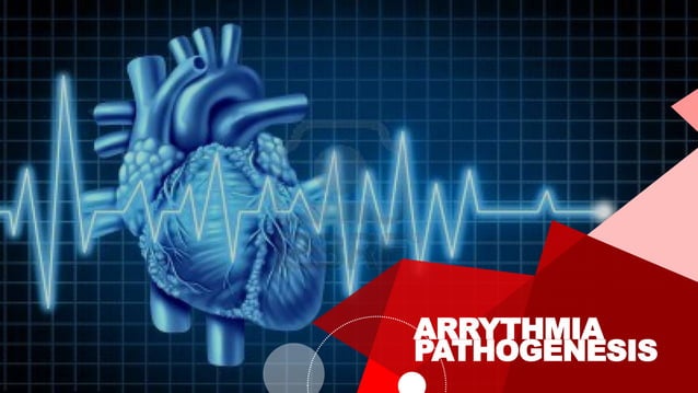 Management of cardiac arrhythmias | PPTX | Heart and Cardiovascular ...