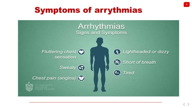 Management of cardiac arrhythmias | PPTX | Heart and Cardiovascular ...