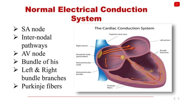 Management of cardiac arrhythmias | PPTX | Heart and Cardiovascular ...