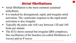 Management of cardiac arrhythmias | PPTX