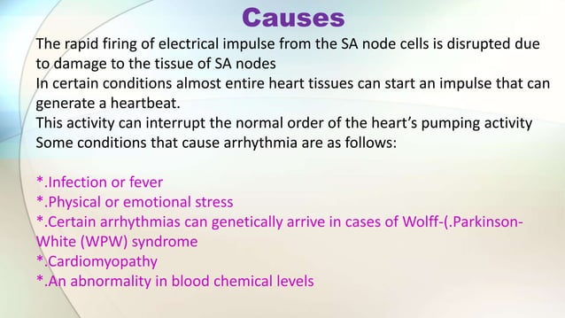 Arrhythmia /Heart Rhythm Disorder -A brief medical study | PPT