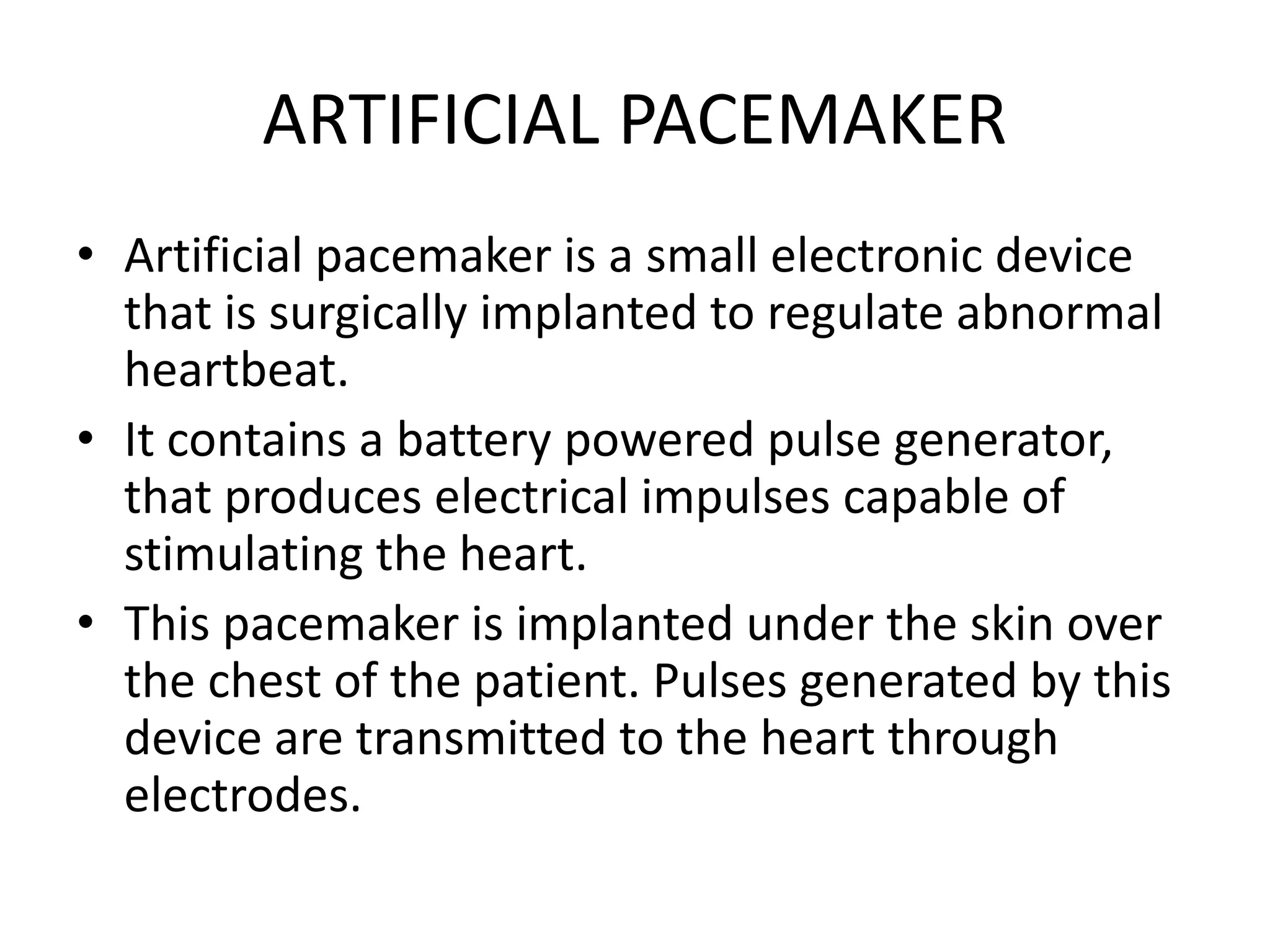 Arrhythmia | PPTX
