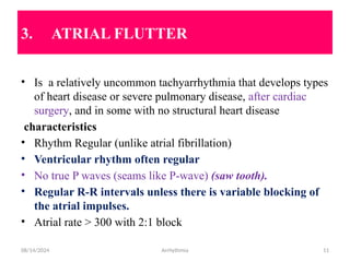 Arrhythmia.pptx power point presentations | PPT