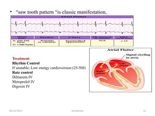 Arrhythmia.pptx power point presentations | PPT