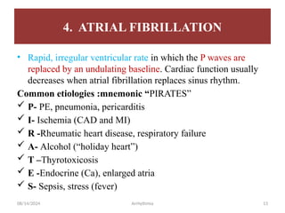 Arrhythmia.pptx power point presentations | PPT