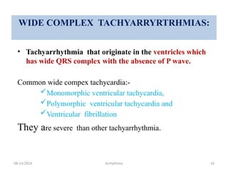 Arrhythmia.pptx power point presentations | PPT