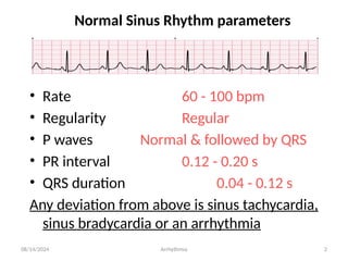 Arrhythmia.pptx power point presentations | PPT