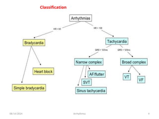 Arrhythmia.pptx power point presentations | PPT
