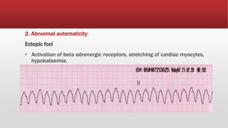 Anti-Arrhythmics | PPTX | Heart and Cardiovascular Diseases | Diseases ...