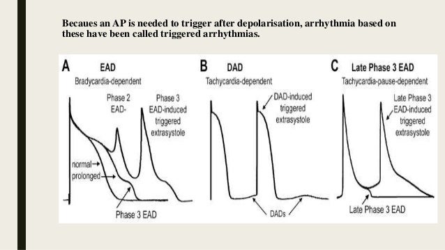 Arrhythmia HEART