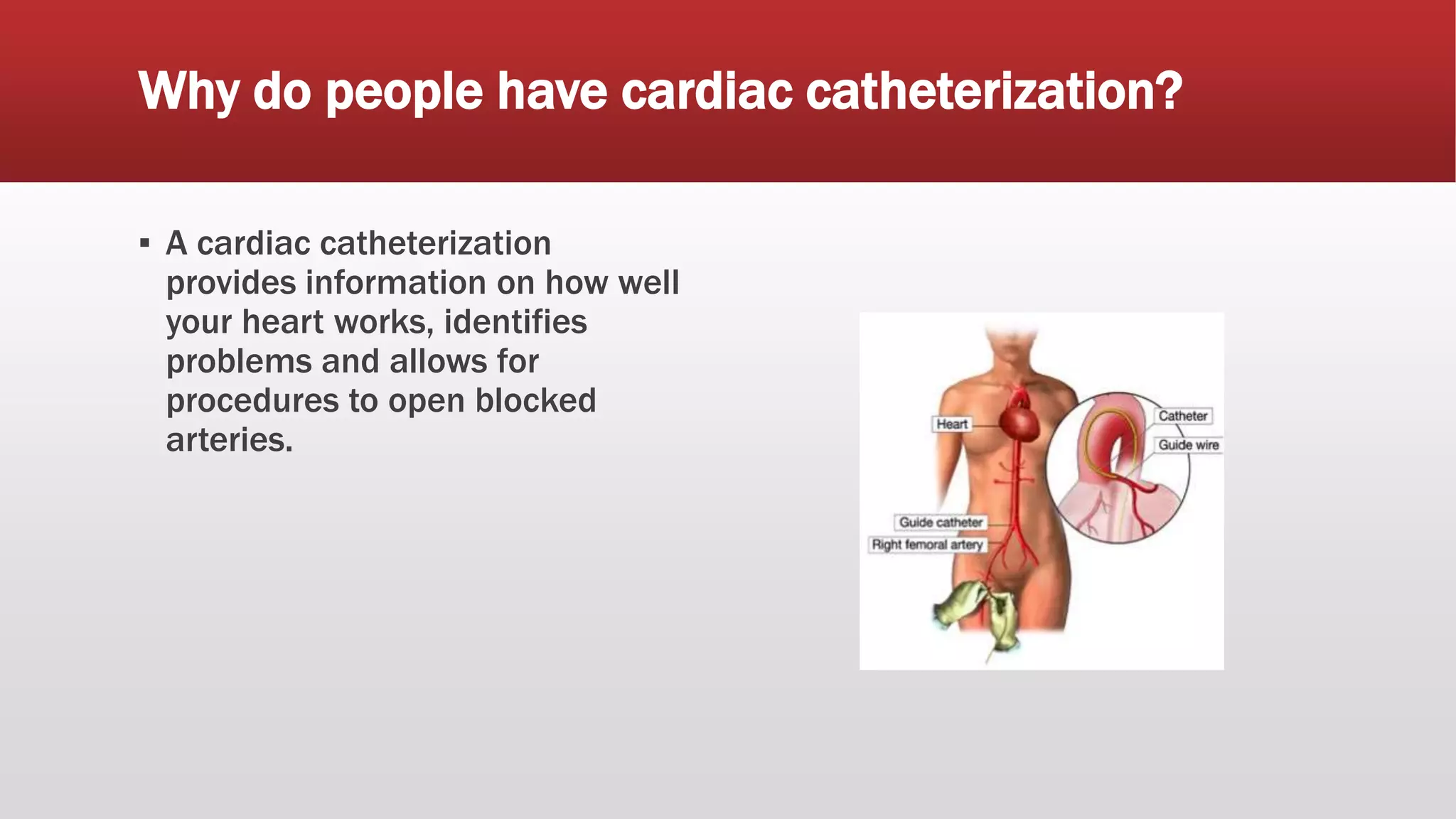 Arrhythmia cardiac catheterization holter_ | PPTX