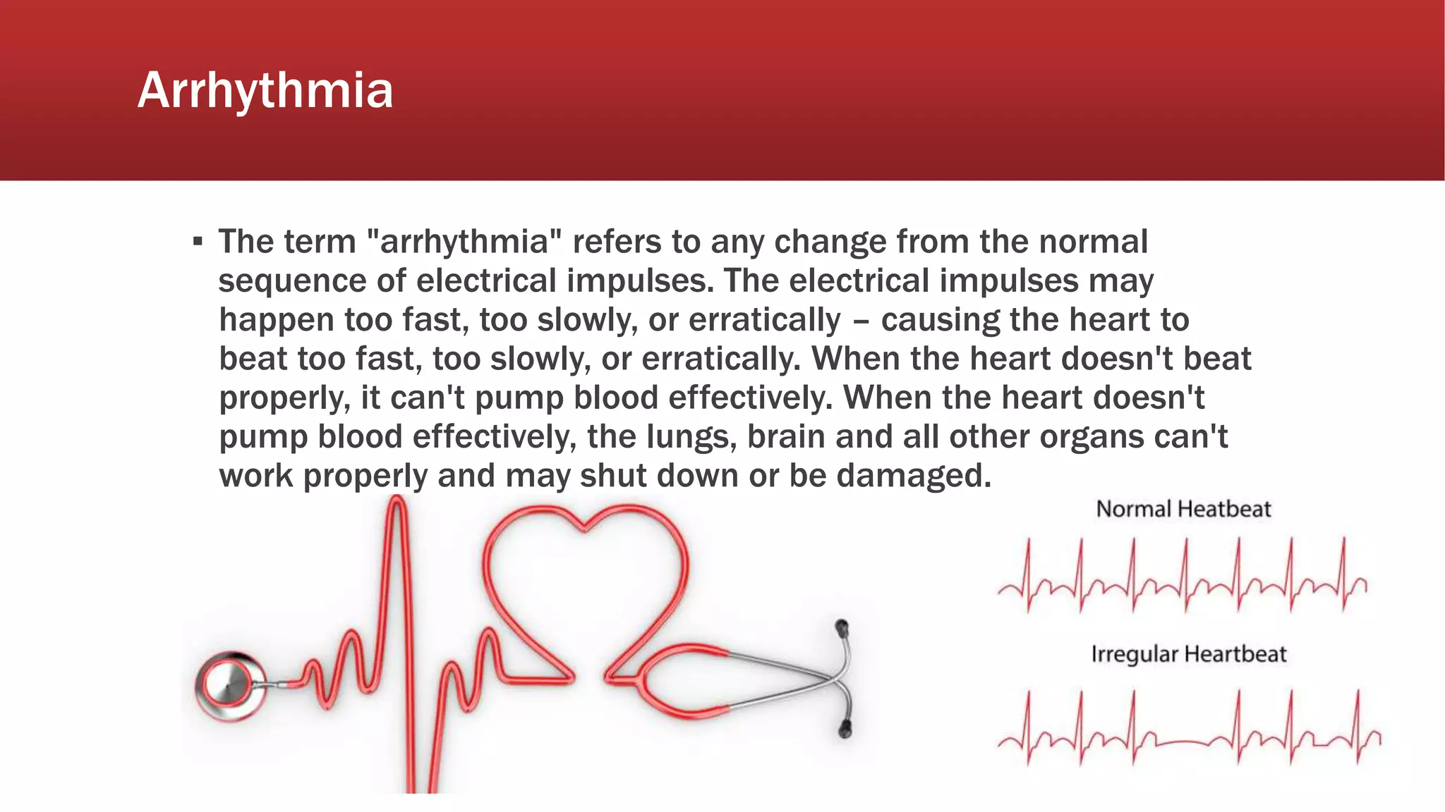 Arrhythmia cardiac catheterization holter_ | PPTX