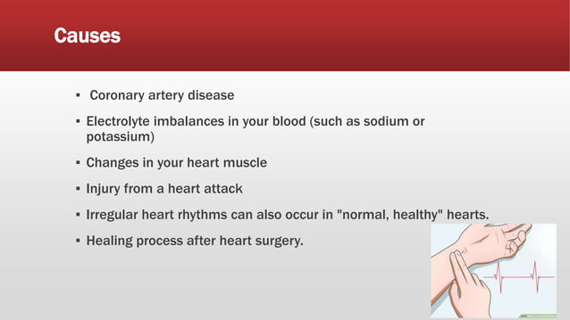 Arrhythmia cardiac catheterization holter_ | PPT