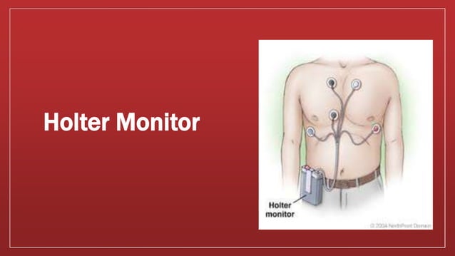 Arrhythmia cardiac catheterization holter_ | PPT