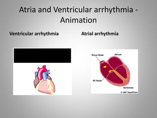 Antiarrhythmic drugs - drdhriti | PPTX