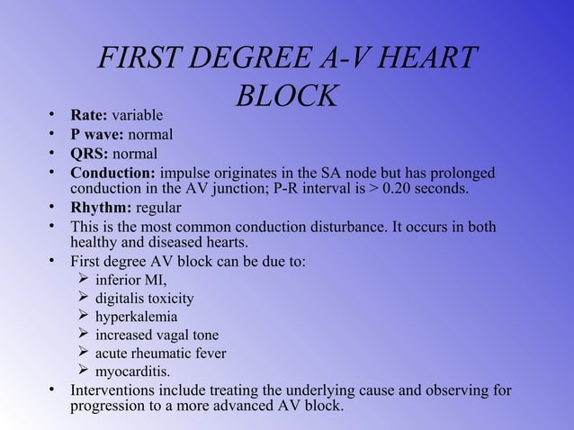 Arrhythmia diagnosis and management | PPT