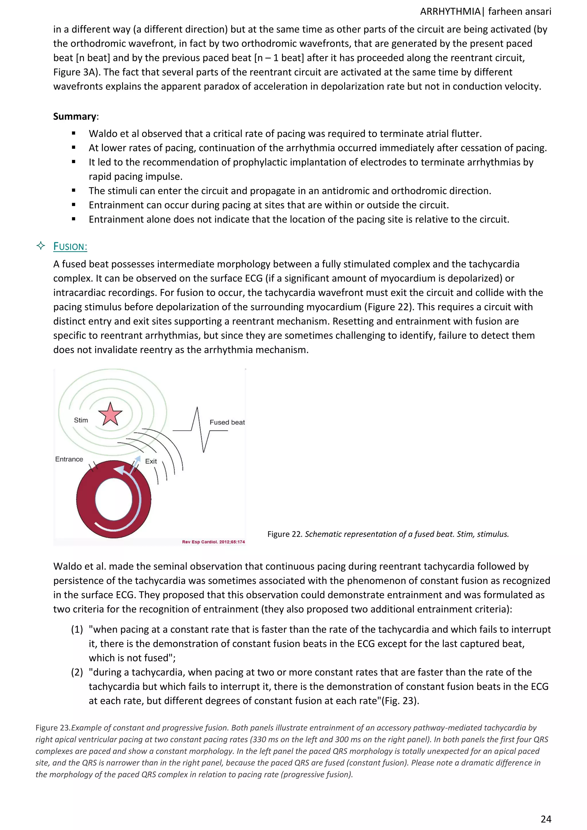 Arrhythmia: Mechanism, Classification, ECG features | PDF