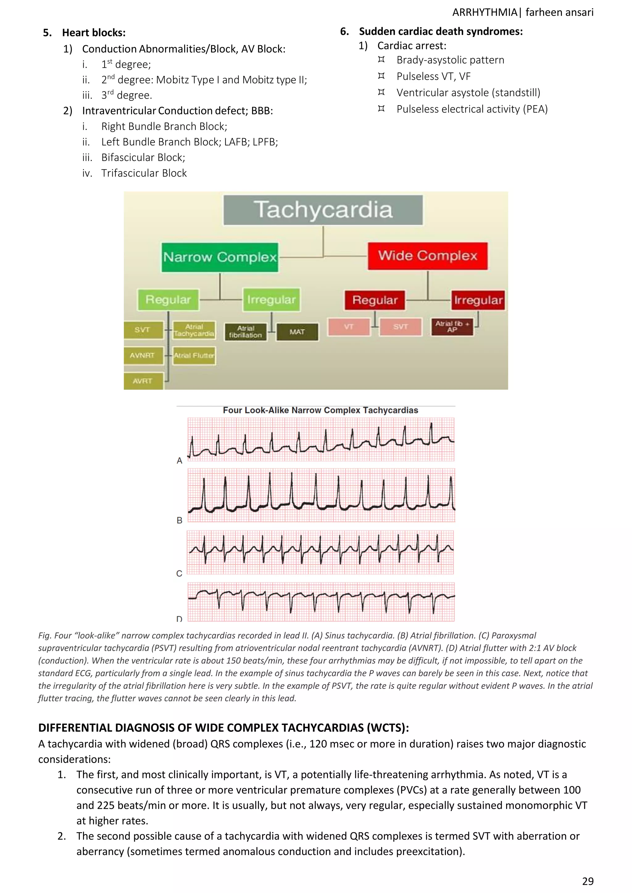 Arrhythmia: Mechanism, Classification, ECG features | PDF | Heart and ...