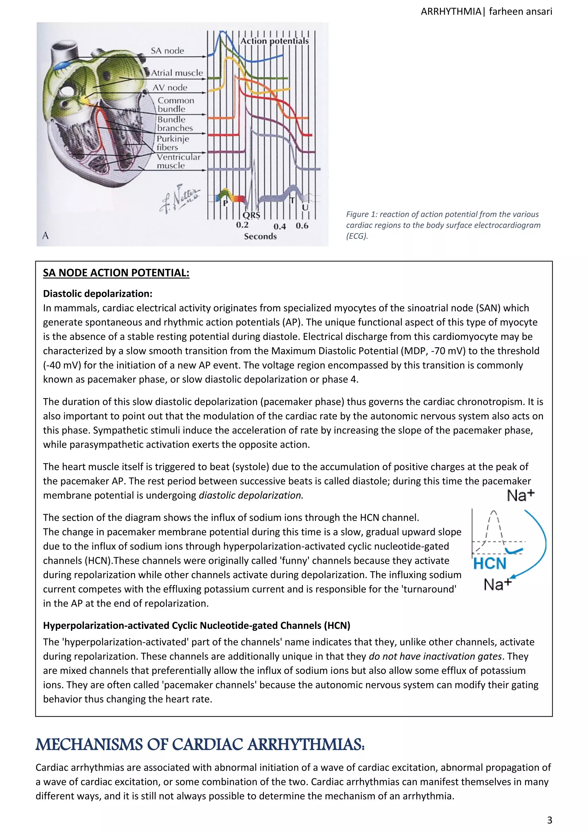 Arrhythmia: Mechanism, Classification, ECG features | PDF