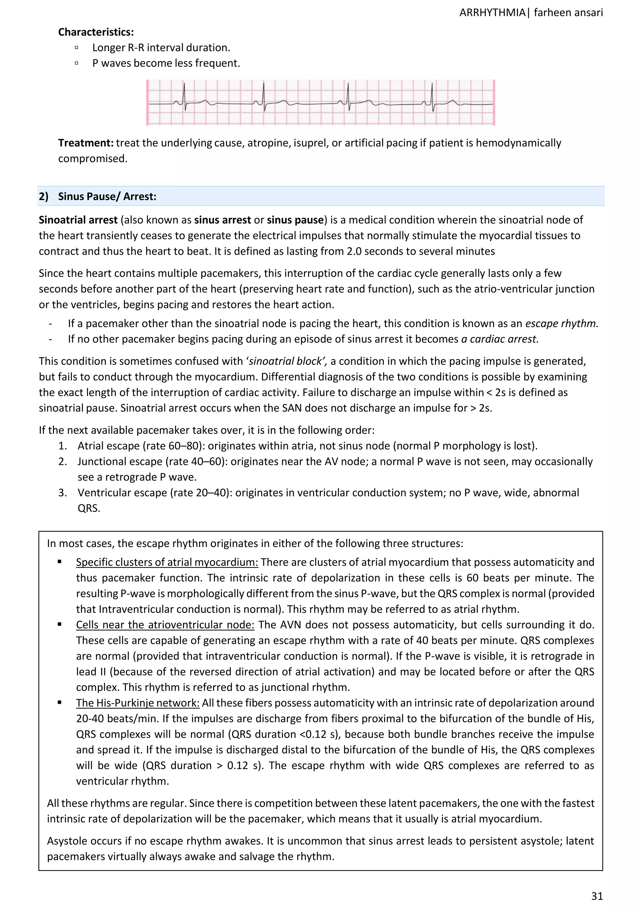 Arrhythmia: Mechanism, Classification, ECG features | PDF | Heart and ...